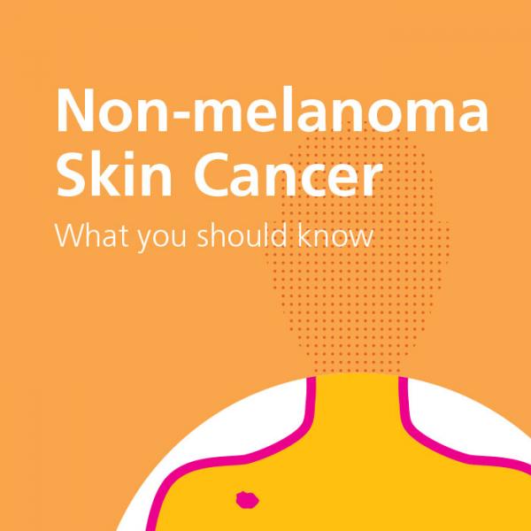 Non-melanoma skin cancer | Irish Cancer Society
